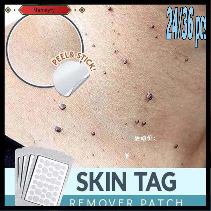 MANLEYTY Beauty Face Care Anti-infection Ance Pimple Patch Skin Tag ...