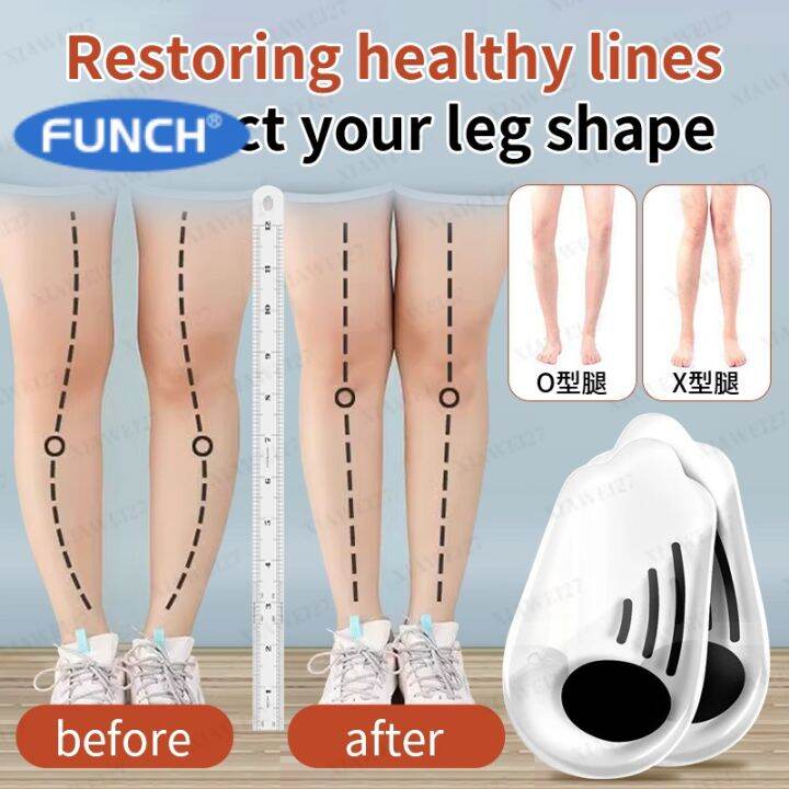 O/X Legs Correction Insoles Straight Leg Artifact Calf Valgus o Shaped ...