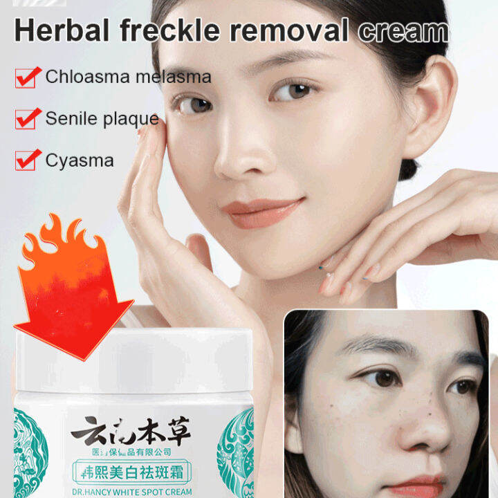greatfunny Natural Whitening Cream for Freckles and Dark Spots | Lazada PH