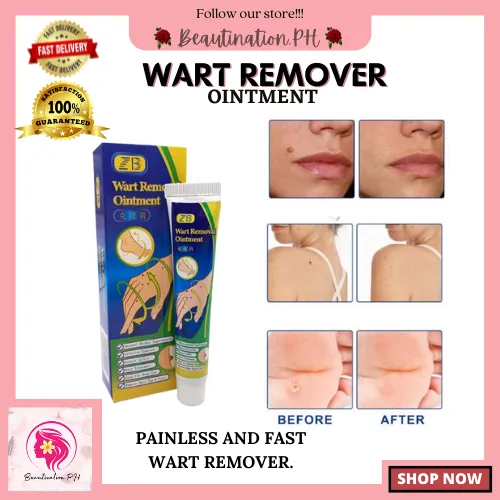 EFFECTIVE Wart Remover Cream Warts Eliminator Ointment Papilloma ...