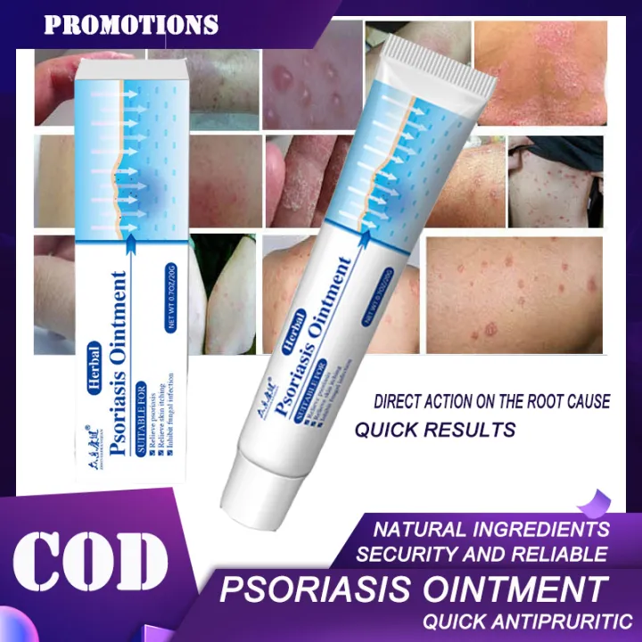 【in stock】Doctor Recommended HERBA Psoriasis Ointment Psoriasis ...