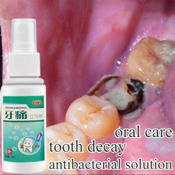Toothache oral spray toothache repellent Toothache Insect Repellent ...