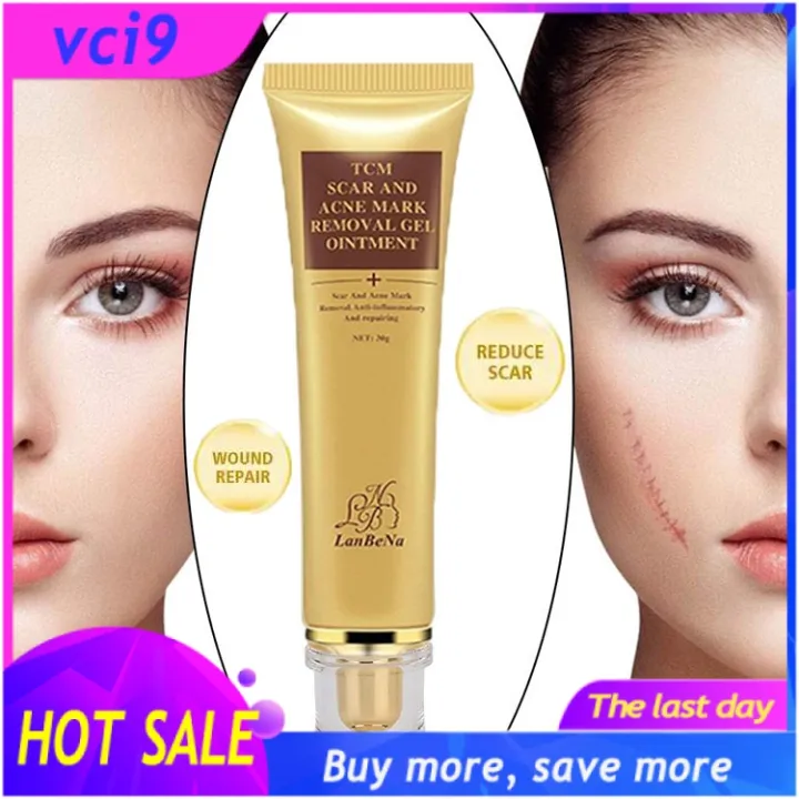 Hot 】Authentic Original TCM Scar Removal Cream Acne Treatment Acne Scar ...