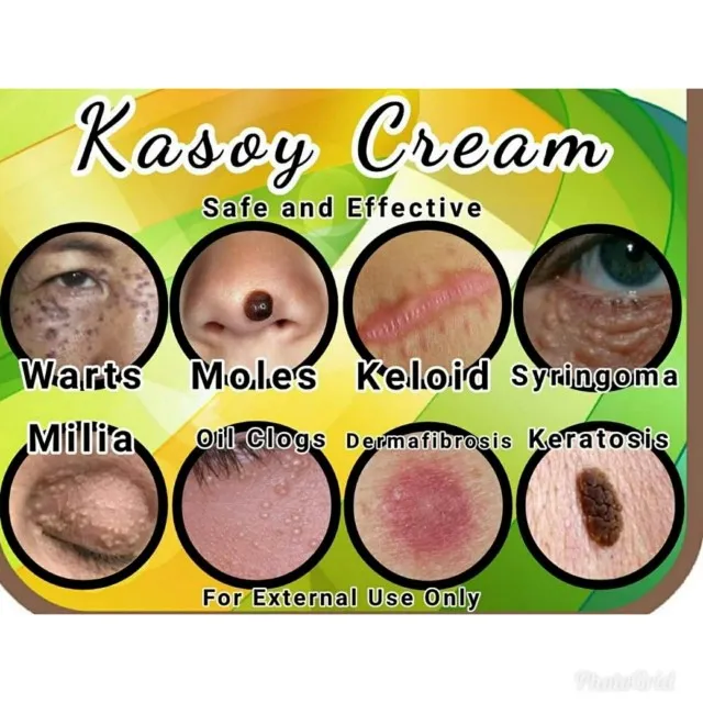 Warts Removal Remover Cream - Maximum Strength- Painlessly Removes ...