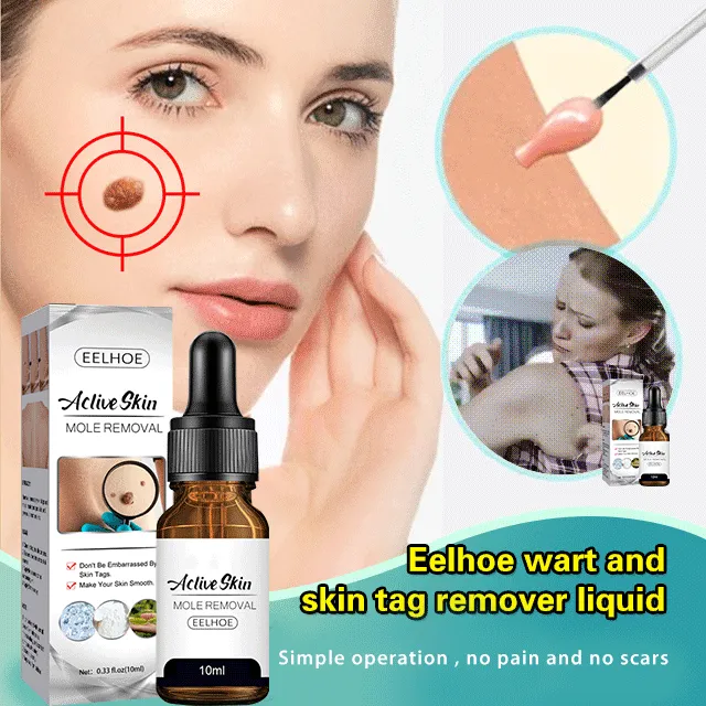 [Buy 1 get 1 Free]Spots and moles removal essence Skin Tag Freckle Wart ...