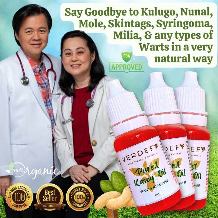 ORIGINAL TANGGAL NUNAL KULUGO WARTS REMOVER MOLE REMOVER SKIN TAG ...