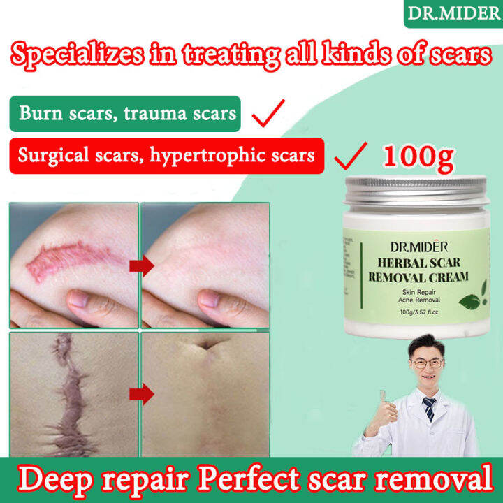 100% effective DR.MIDER scar remover cream 100g Repair Skin Care For ...