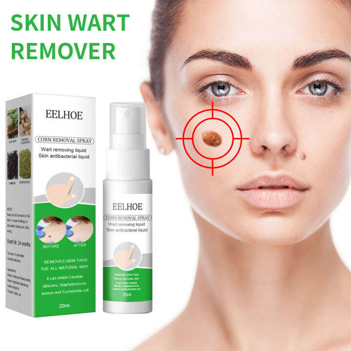 20ml Skin Tag Wart Remover Spray Fast Acting Wart Remover Liquid for ...