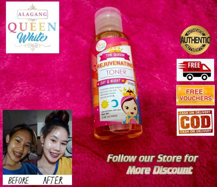 Queen White Rejuvenating Toner - Authentic (Glass Skin, Anti Acne, Anti ...