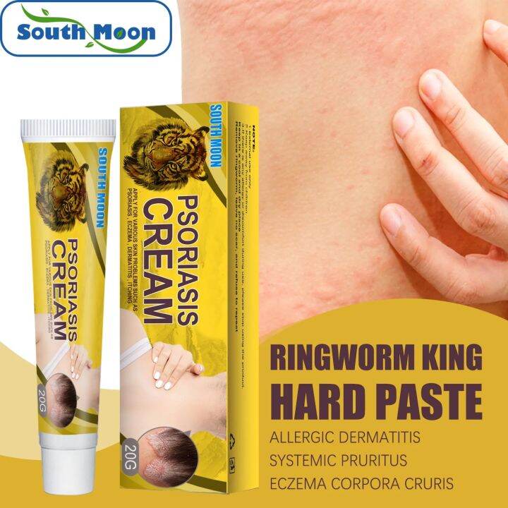 Psoriasis Cream Eczema Cream 🔥 Scabies Scabies Itchy Ringworm Legs Eat ...
