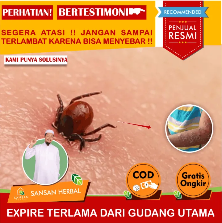 Salep Kulit Akibat Tungau, Salep Gigitan Tungau, Salep Gatal Tungau ...