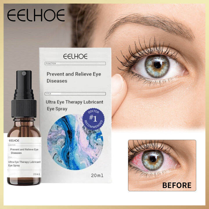 Eelhoe Ultra Eye Therapy Lubricant Eye Spray Prevent and Relieve Eye ...