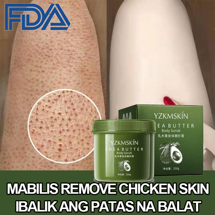 Chicken Skin Remover/Bleaching Whipped Scrub/Bright White Lotion ...