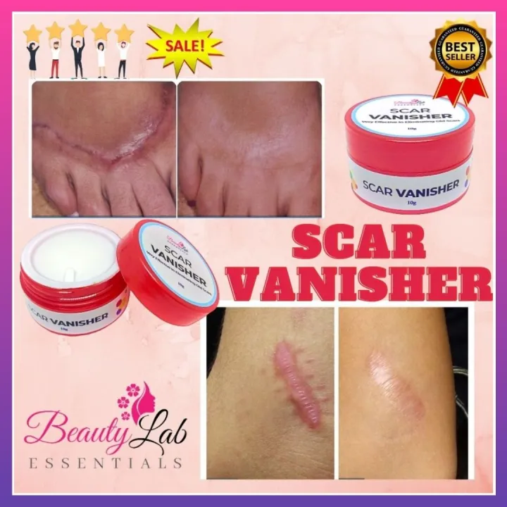 SCAR VANISHER 10g for STRETCH MARKS Scar remover Cream for old scar on ...