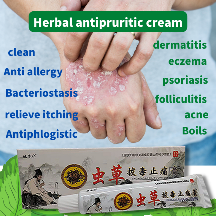 20 G Skin Antipruritic Cream Skin Pruritus Rash Eczema Dermatitis