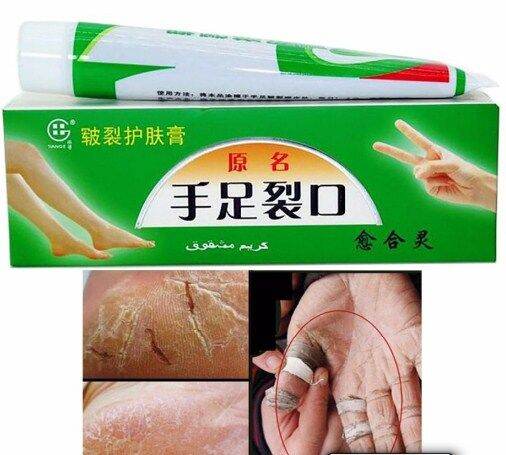 Salep Tumit Pecah Salep Kulit Tangan Ampuh Salep Cina | Lazada Indonesia