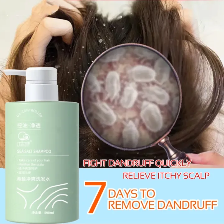 Anti-dandruff Anti-itch Anti-mite Shampoo Amino Acid Sea Salt Shampoo Refreshing Oil-controlling ...