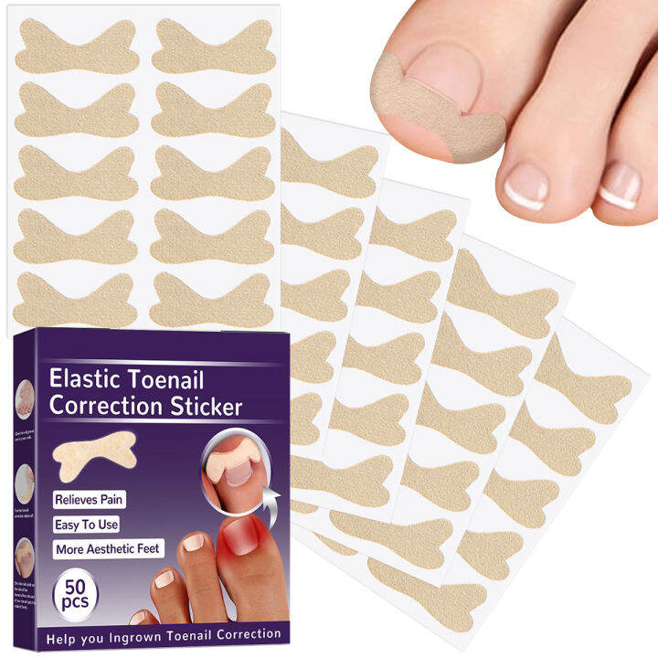 50 Pcs Ingrown Toenail Corrector Stickers Breathable Self-Adhesive ...