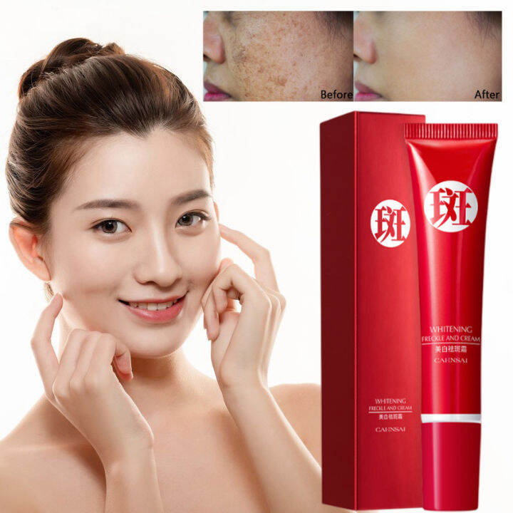 [READY STOCK]Whitening Freckle Remover Cream/Krim jeragat Pigmentation ...