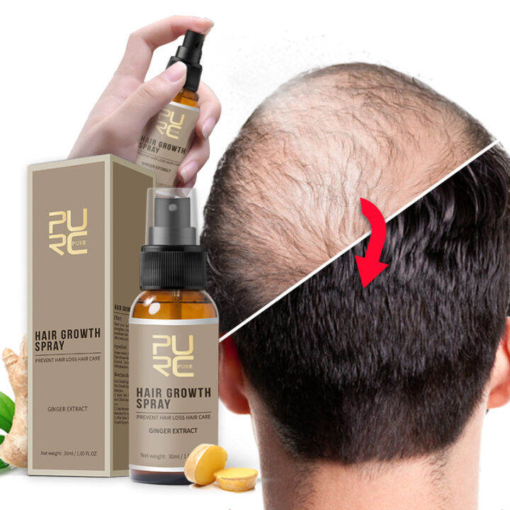 20ML Fast Powerful Hair Grower Hair Care 100% Pure Natural Treatment ...