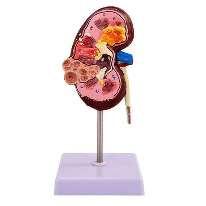【Ready stock】 3-D Human Body Organ Kidney Models Anatomical Model ...