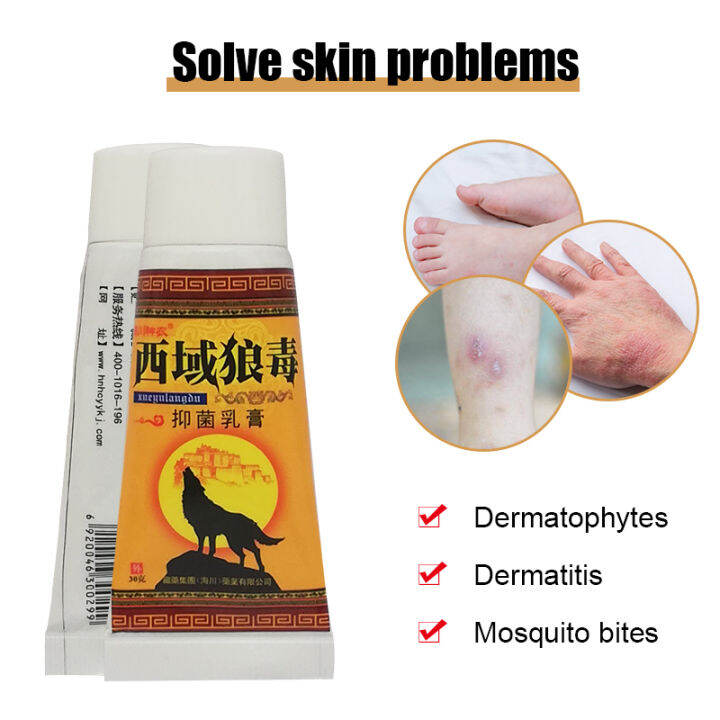Chinese Medicine Anti-itch Antibacterial Ointment Relieve Fungal ...