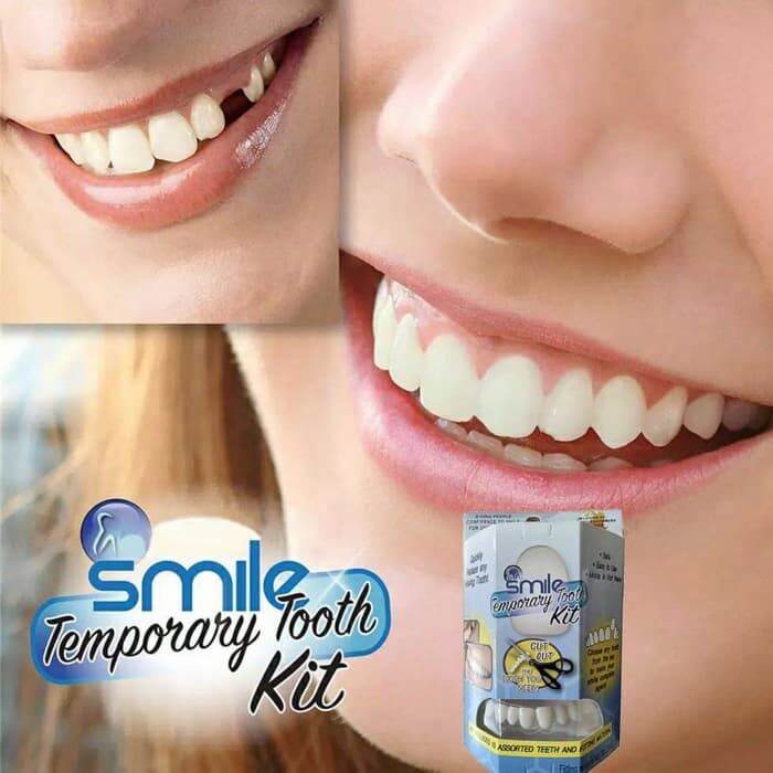 Instant Smile Temporary Tooth Kit Replace A Missing Tooth In Minutes ...