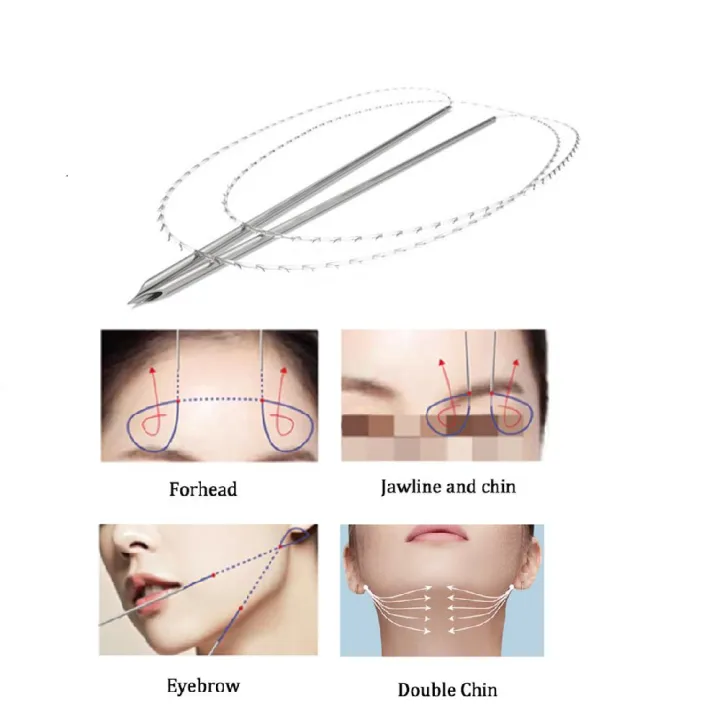 Pdo Pcl Double Arm Needle Thread Eyebrow Lift Make Fox Eye Cat Eyes ...