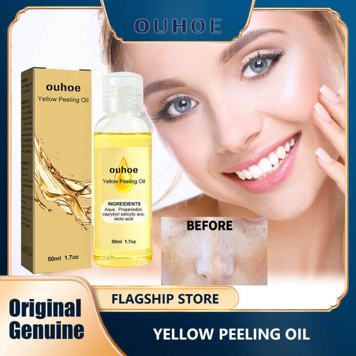 Ouhoe Yellow Peeling Oil Whitening and Exfoliating Oil Deeply Cleans ...