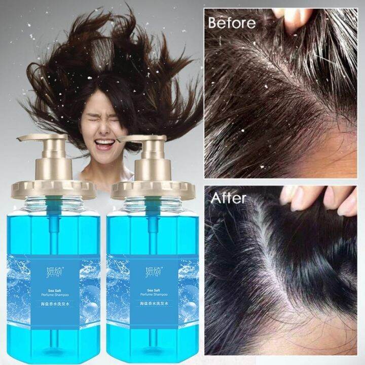 【COD]weeyu3227 500ML Sea Salt Shampoo Anti Dandruff Shampoo Psoriasis Shampoo For Scalp Itching ...