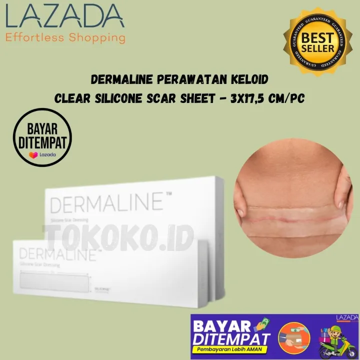 Perawatan Keloid - Dermaline - Clear Silicone Scar Sheet -3x17,5 cm/pc ...