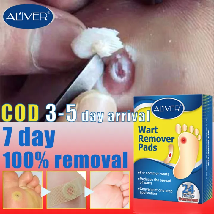 Local delivery Aliver 24Pcs Feet Corns/ Warts Removal Patch Pain Relief ...