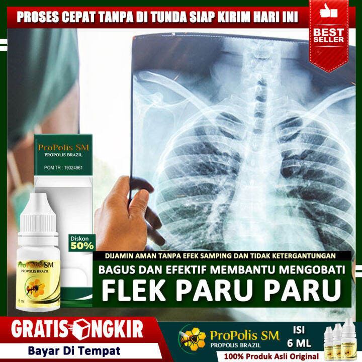 Obat Flek Paru Paru Anak Dan Dewasa - Batuk Flek Paru Paru, Pembersih ...
