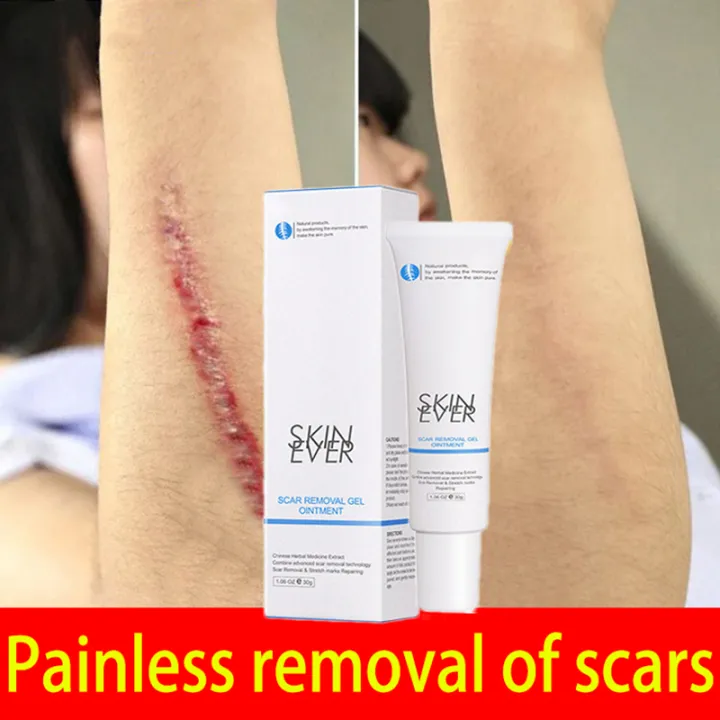 Scar gel Old scar remover Deep into the skin Repair scars Moisturize ...