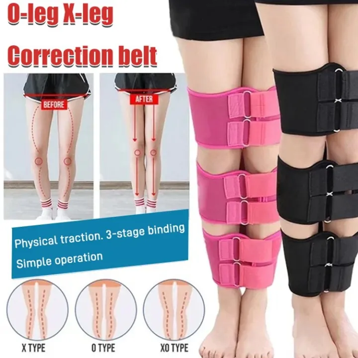 O-leg x-leg correction belt | Lazada PH
