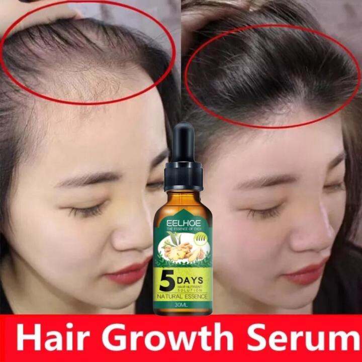 C10 Eelhoe Hair Growth Serum Penumbuh Rambut Wanita Pria Secara Cepat