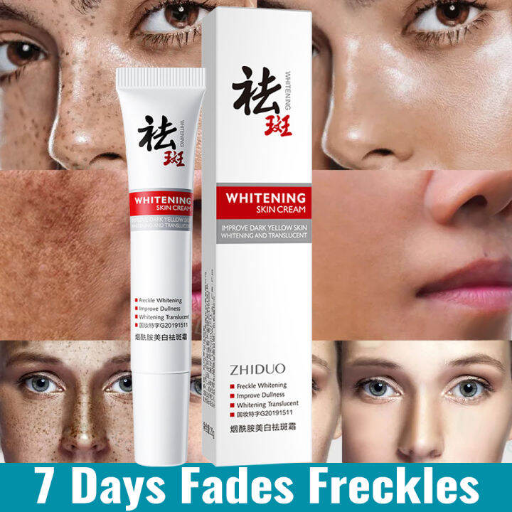 Original Melasma Cream Pekas Remover Collagen Pekas Remover Whitening ...