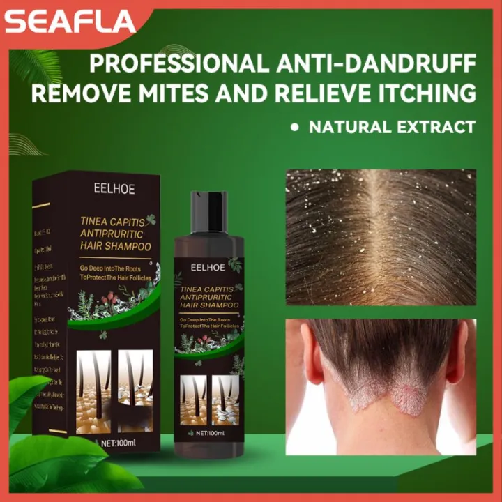 Eelhoe 100ml Tinea Capitis Antipruritic Shampoo, Dandruff, Oil Control ...
