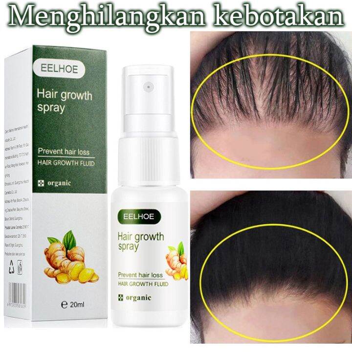 Semprotan penumbuh rambut Hair growth serum Hair growth spray 20ml ...