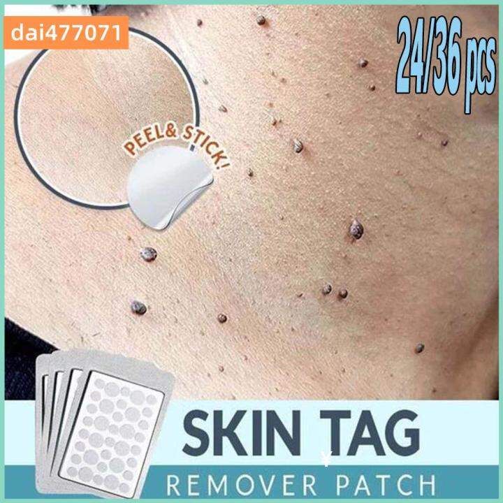DAI477071 Women Body Anti-infection Face Care Ance Pimple Patch ...