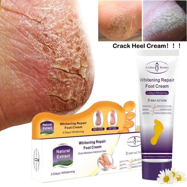 HUGE SALE! AUTHENTIC Foot Cream for Dry and Rough Heels, Cracked Heel ...