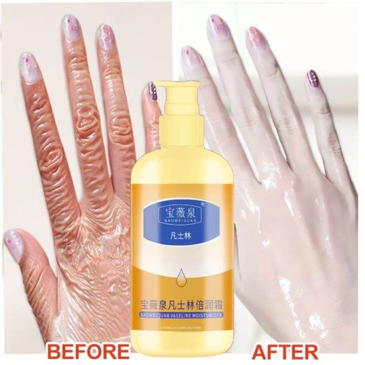 Vaseline Moisturizing Cream 250ML for Face and Body Whitening Anti ...