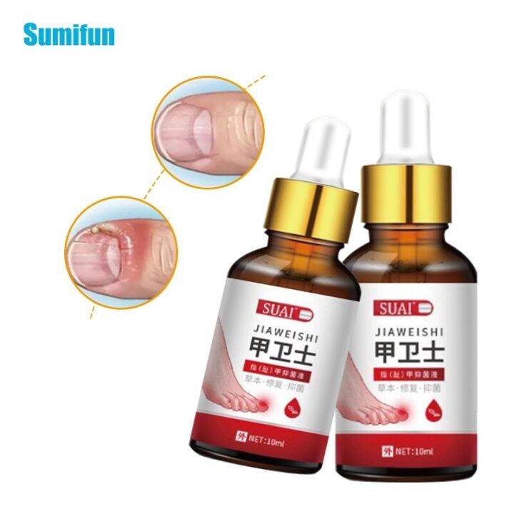 10ml Onychomycosis Treatment Oil Fungal Nail Repair Essence Serum Herbal Fungus Removal Gel Anti ...