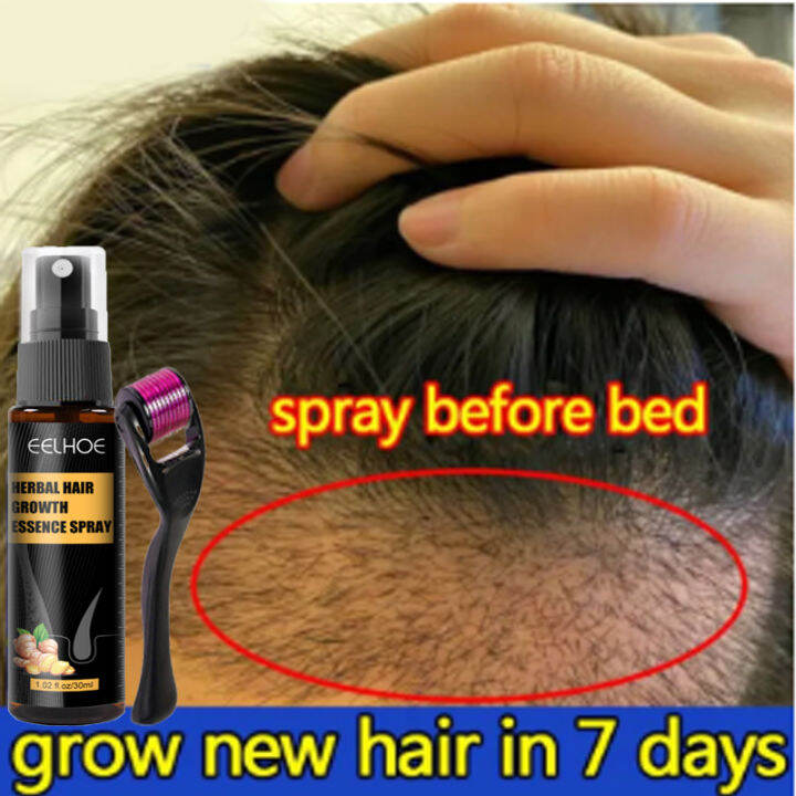Hair Grower For Men Original Spray Minoxidil Hairtech Original Hair