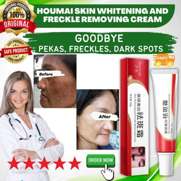 Original Pekas Cream Melasma Remover Cream Collagen Freckle Remover ...