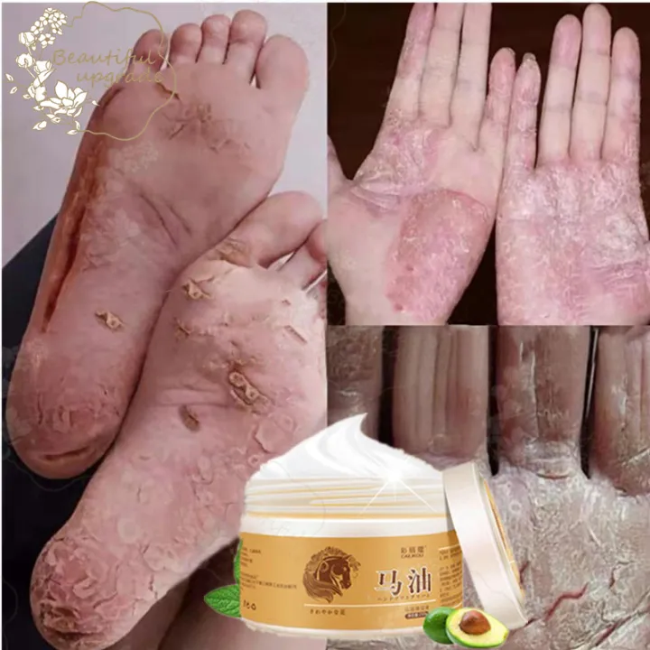 【Up to 50% off】COD Hand Cream For Dry Hands Cracked Heel Remover Foot ...