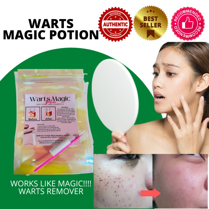 Warts Magic Potion | Lazada PH