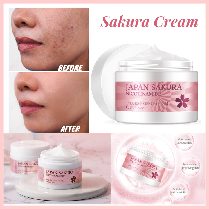 Japan Sakura Cream 25g Melasma and Pekas remover cream for face Korean Skincare product ...