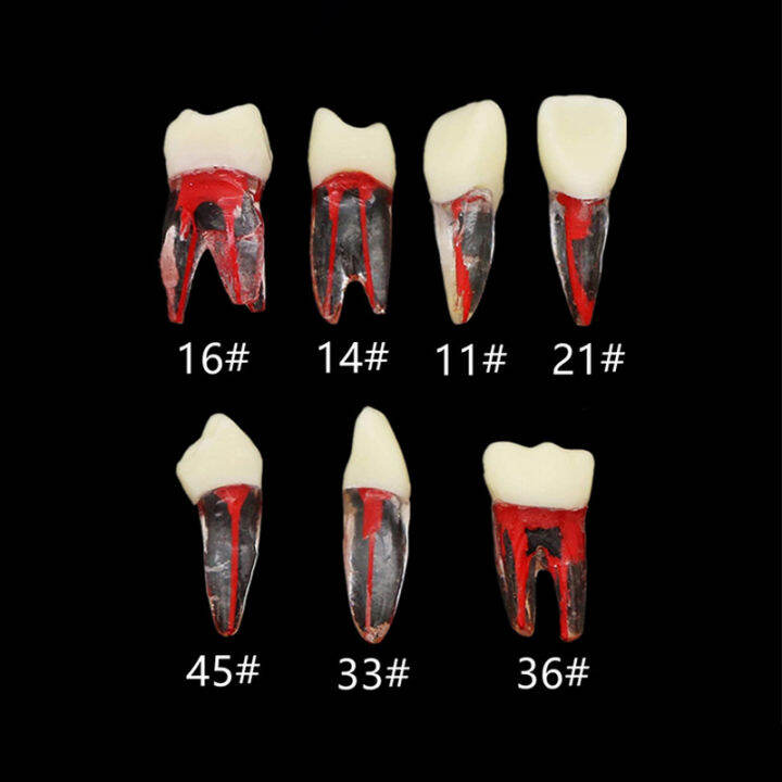 Dental Endodontic Tooth Model With Colored Root Canal And Pulp Model ...