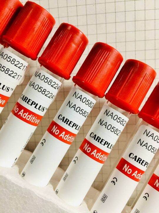 Red Vacutainer with No Additive or Red Vacuum Tube for Veni Practice ...